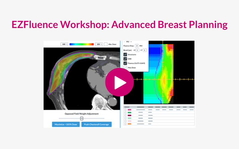 Ezfluence Workshop Advanced Breast Planning Resource